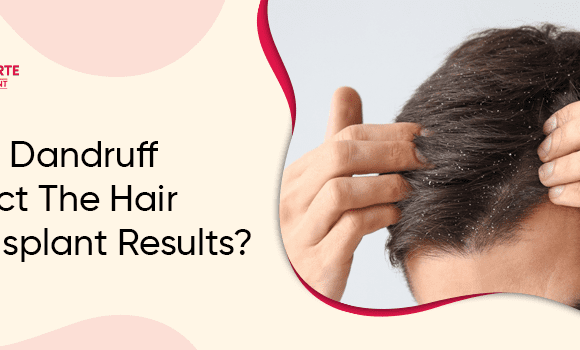 Dr. Vikas Gupta: Hair transplant is a boon in medical advancement to ...